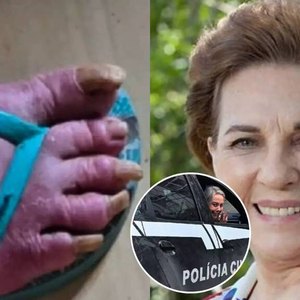 Quem é a famosa atriz da TV Globo encontrada em situação de abandono em ...